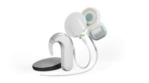 Implante Coclear | OtoLógica